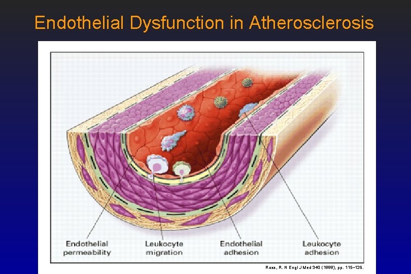 EPDM 566 Epid of CVD Pathobiology of Atherosclerosis