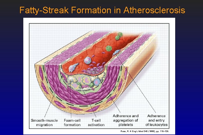 EPDM 566 Epid of CVD Pathobiology of Atherosclerosis