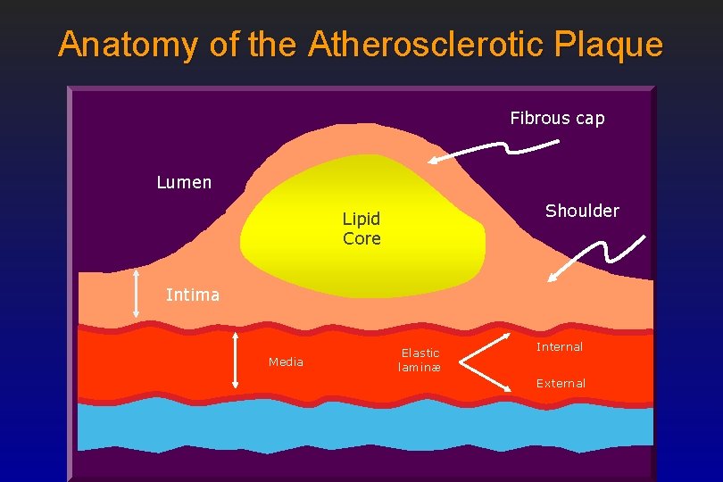 EPDM 566 Epid of CVD Pathobiology of Atherosclerosis