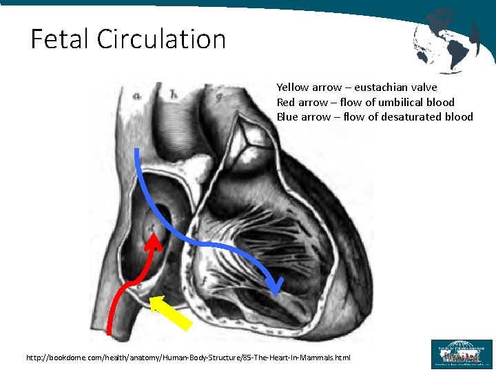 Pulmonary Hypertension in Congenital Heart Disease Greg Latham