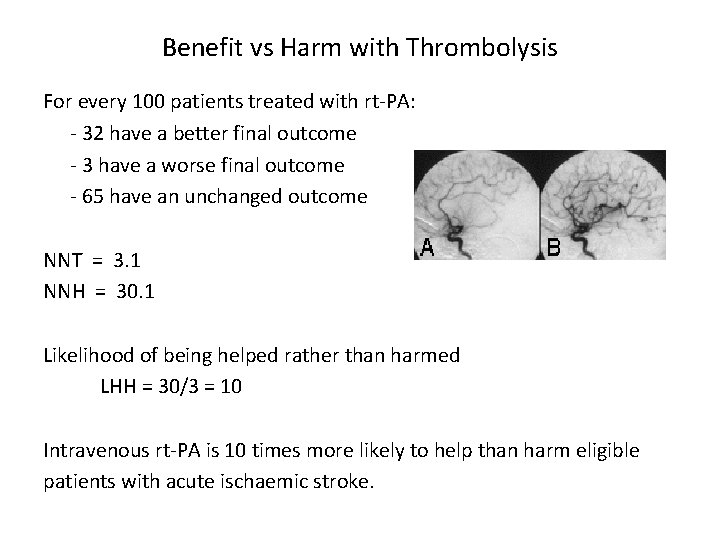 STROKE ACUTE CARE and THROMBOLYSIS Adrian Pace Neurology
