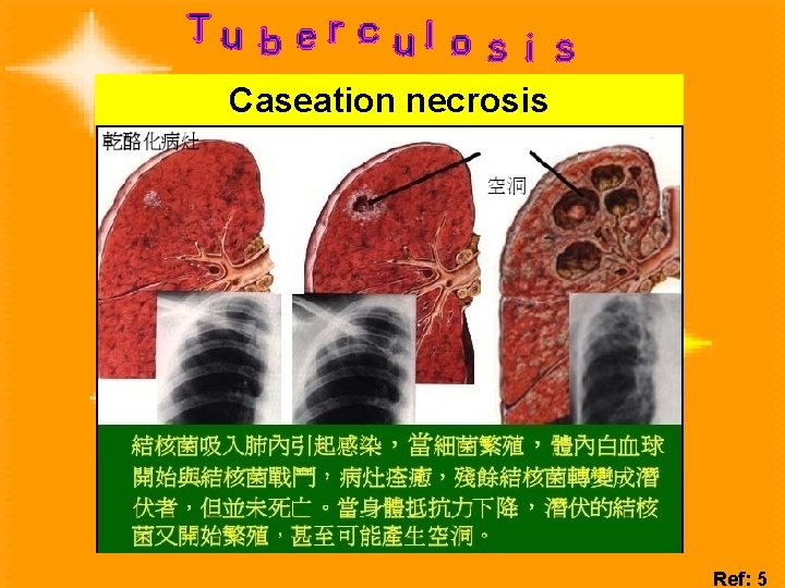 Understand 1 Virulence factor of bacteria 2 Koch