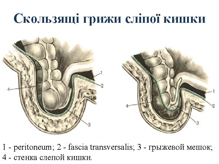 I epigastrium 1 regio epigastrica 2 regio hypochondriaca