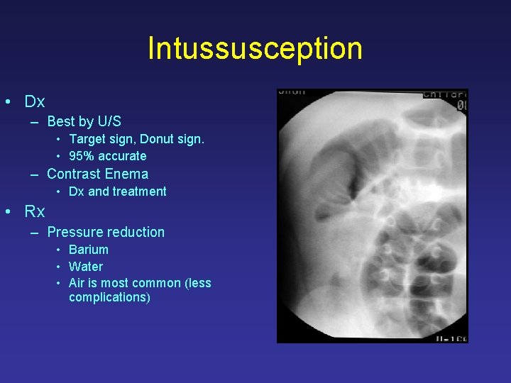Abdominal Emergencies in Pediatric Ayman AlJazaeri Pediatric Surgery