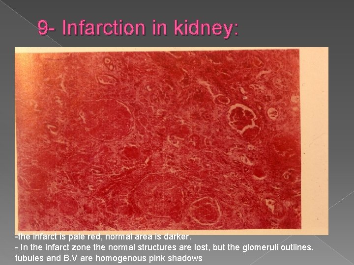 CIRCULATORY DISTURBANCE Classification 1 Disturbance in the volume