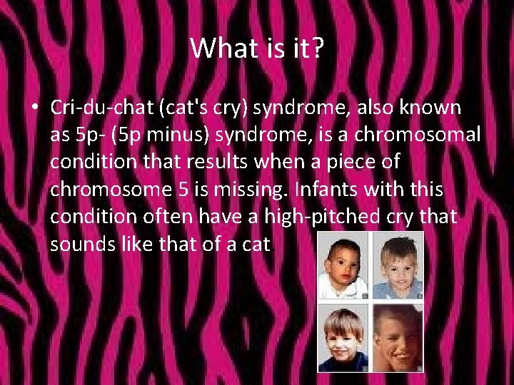 CriduChat Syndrome Cry of the Cat By Courtney