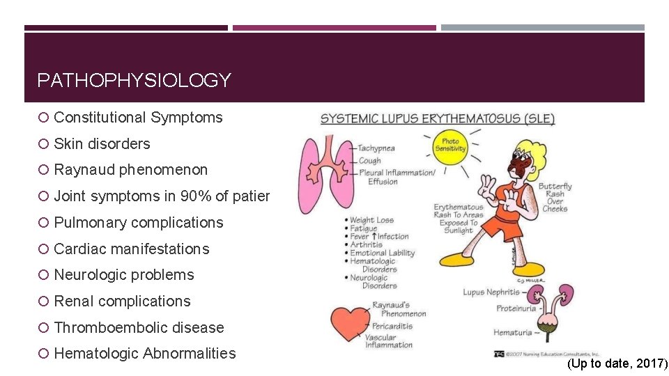 SYSTEMIC LUPUS ERYTHEMATOSUS CHRISTINE PETERSON OBJECTIVES Identify the