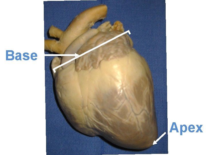Heart Dissection Base Apex Auricles Earshaped extensions of