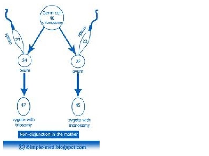ABNORMAL MEIOSIS Nondisjunction occurs when two homologous chromosomes