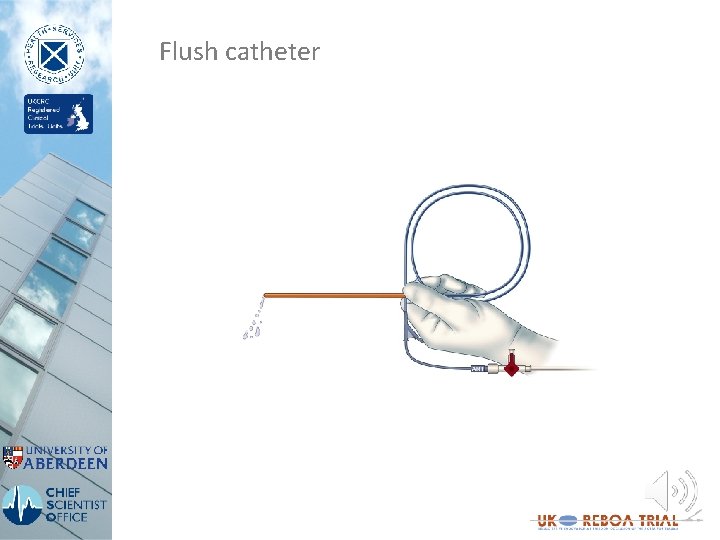 Balloon Occlusion Robbie Lendrum Deputy Clinical Lead and