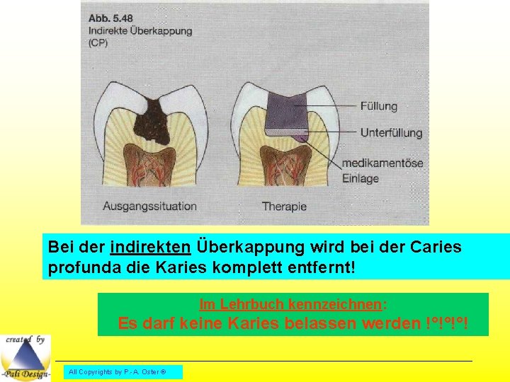 LERNFELD 5 Endodontische Behandlungen begleiten 16 Therapie der