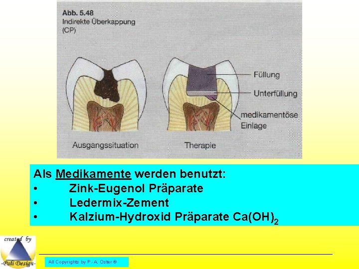 LERNFELD 5 Endodontische Behandlungen begleiten 16 Therapie der