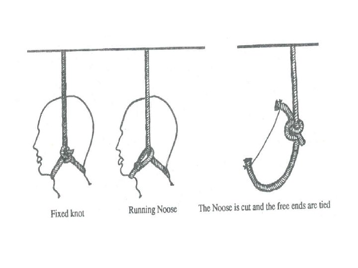 PARTHA BHATTACHARYA Definition of Death Medically and scientifically