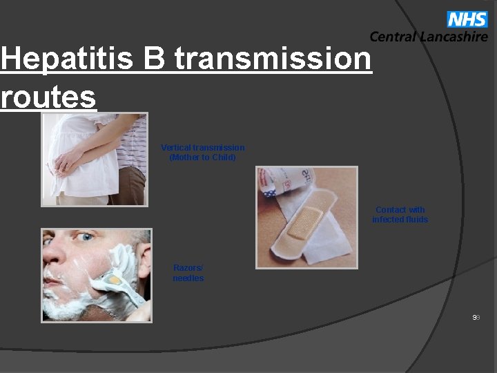 PG Lecture 17 07 2020 Hepatitis B Virus