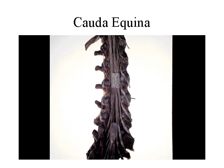 Central Nervous System CNS Brain and Spinal Cord