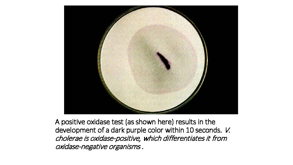 Cholera diagnosis and control DIAGNOSTIC LABORATORY TESTS v