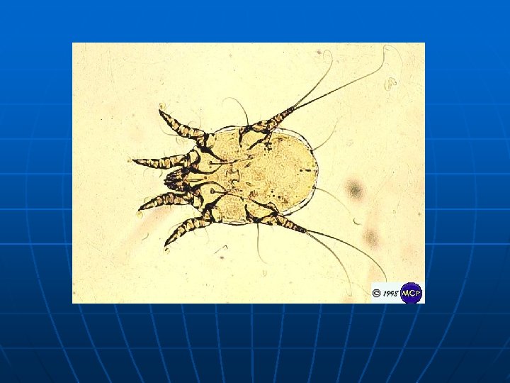 Skin Scrapes and Their Parasitic Friends Clinical Pathology