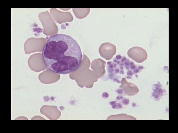 PREPARATION OF BLOOD SMEAR There are three types