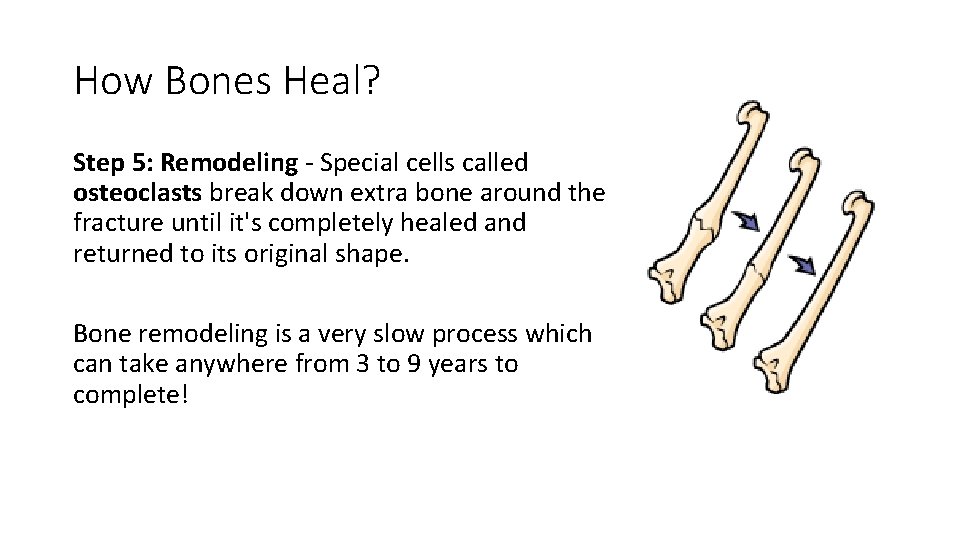 Skeletal System Joints and Diseases Bell Work 1