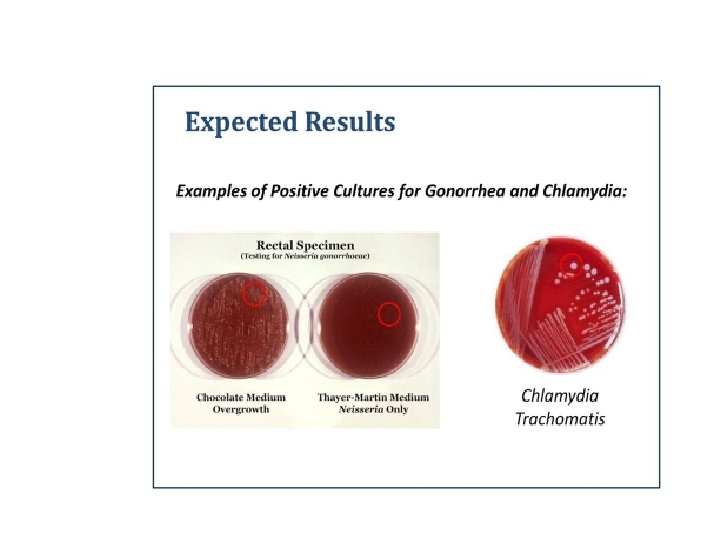 Chlamydia Dr Eman Albataineh Diagnosis 1 Staining 2