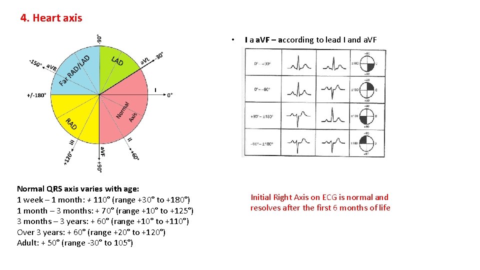 ECG changes in children Pediatric Cardiac Centre Bratislava