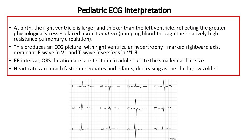 ECG changes in children Pediatric Cardiac Centre Bratislava