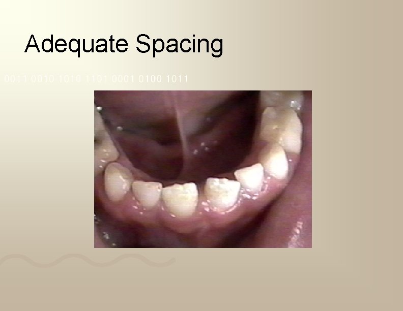 Mixed Dentition Occlusion and Analysis Dr S E