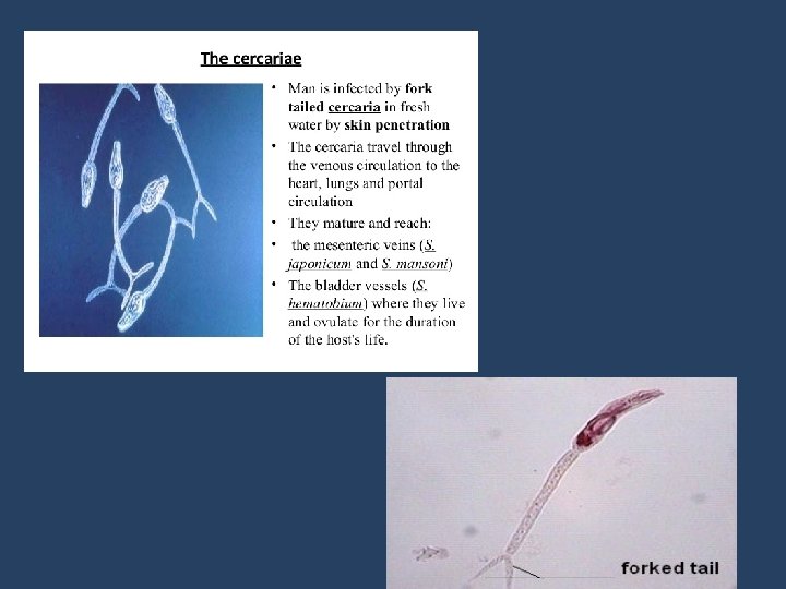 PARASITIC PLATYHELMINTHES FLAT WORMS Schistosoma haematobium BLOOD FLUKE