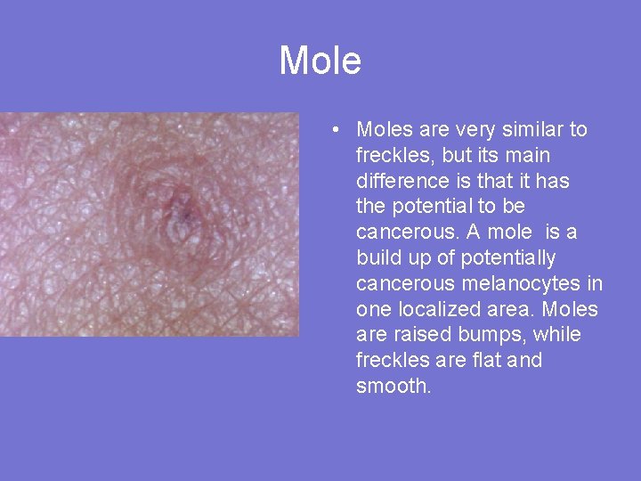 The Many Wonders of Skin By Lucy Lavine