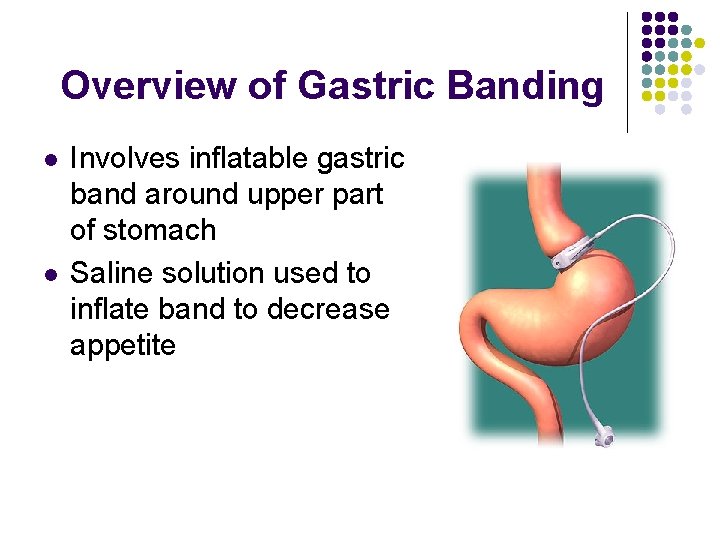 SelfAdjusting Gastric Banding System Erin Crosby Andrew Dickerman
