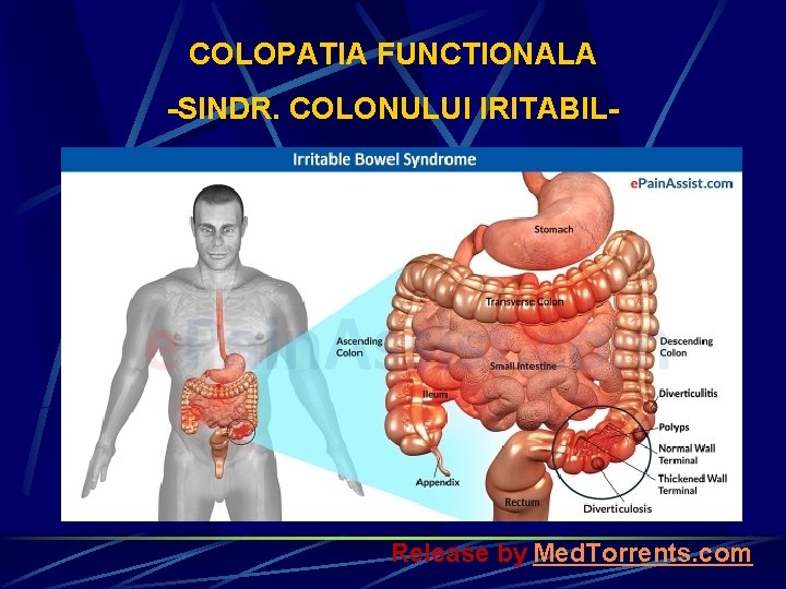 COLOPATIA FUNCTIONALA SINDR COLONULUI IRITABIL Release by Med