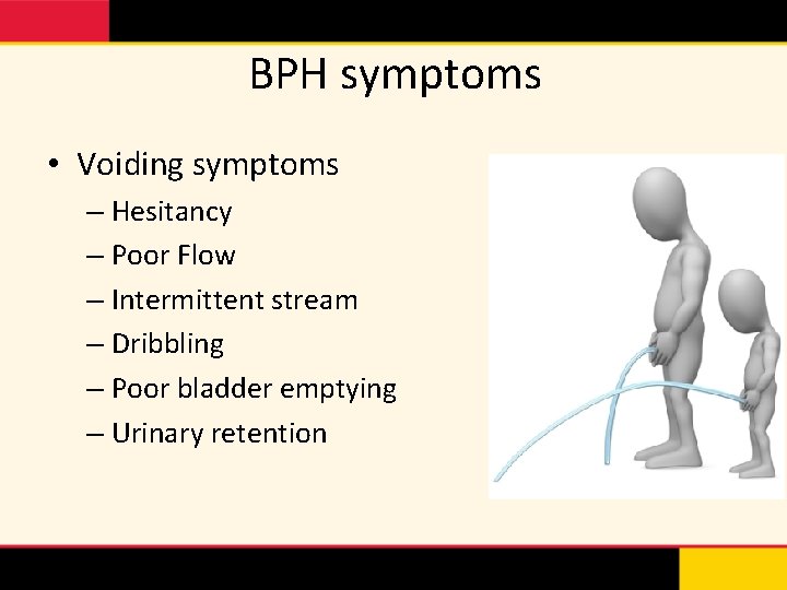 Prostate Embolization New Treatment Option for BPH Howard