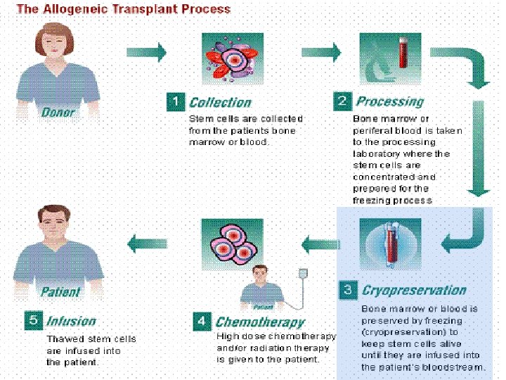Transplantation Principle of Hematopoietic stem cell transplantation 24