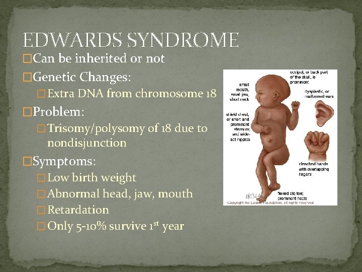 MISTAKES IN MEIOSIS GENETIC DISORDERS Chromosomal Abnormalities KARYOTYPES