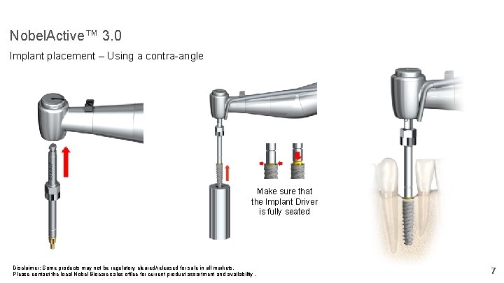 Nobel Active Handson Drill protocol Location date Presenter