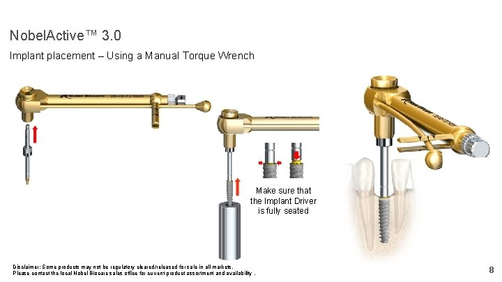 Nobel Active Handson Drill protocol Location date Presenter