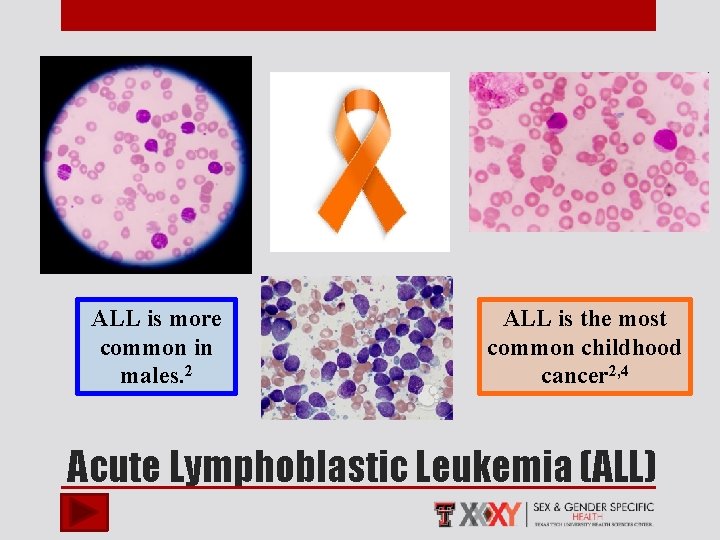 Acute Leukemias Updated September 2020 TOPIC SLIDE ACUTE
