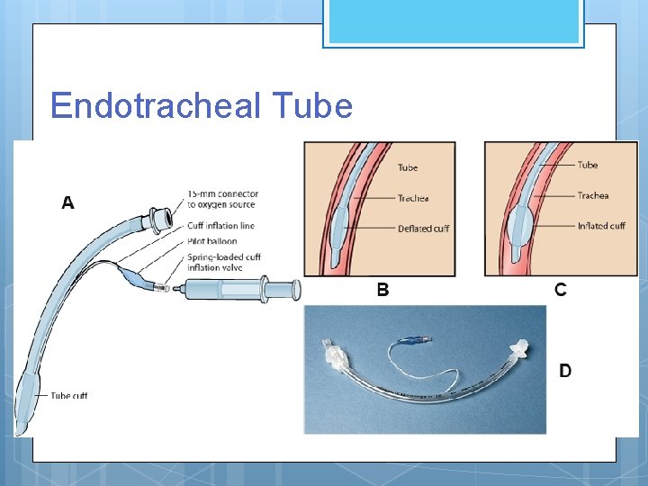 Artificial Airways Artificial Airways Endotracheal ET intubation Placement