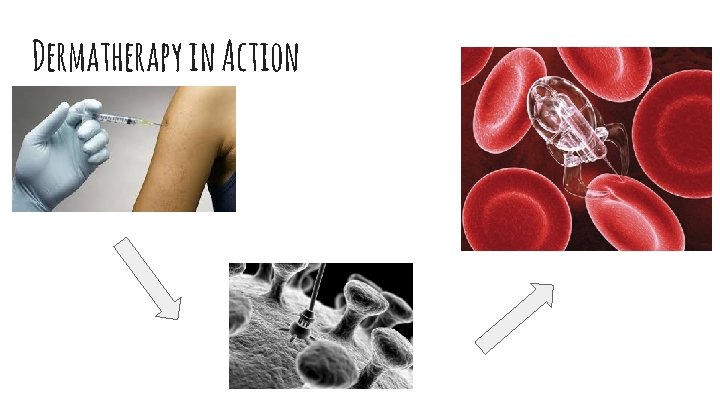 Curing Melanoma Melanoma Skin Cancer Lifestyle Choices Ultraviolet