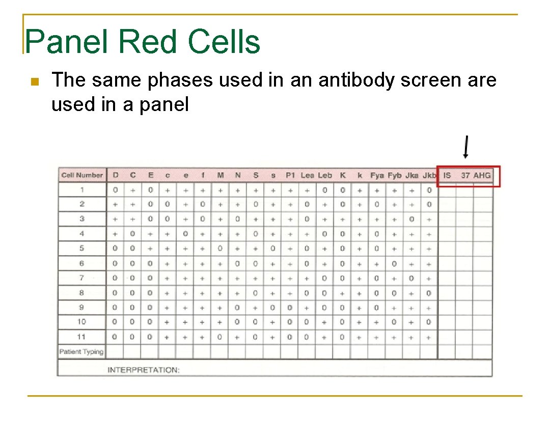 Practical Blood Bank Lab 7 Antibody Identification Antibody