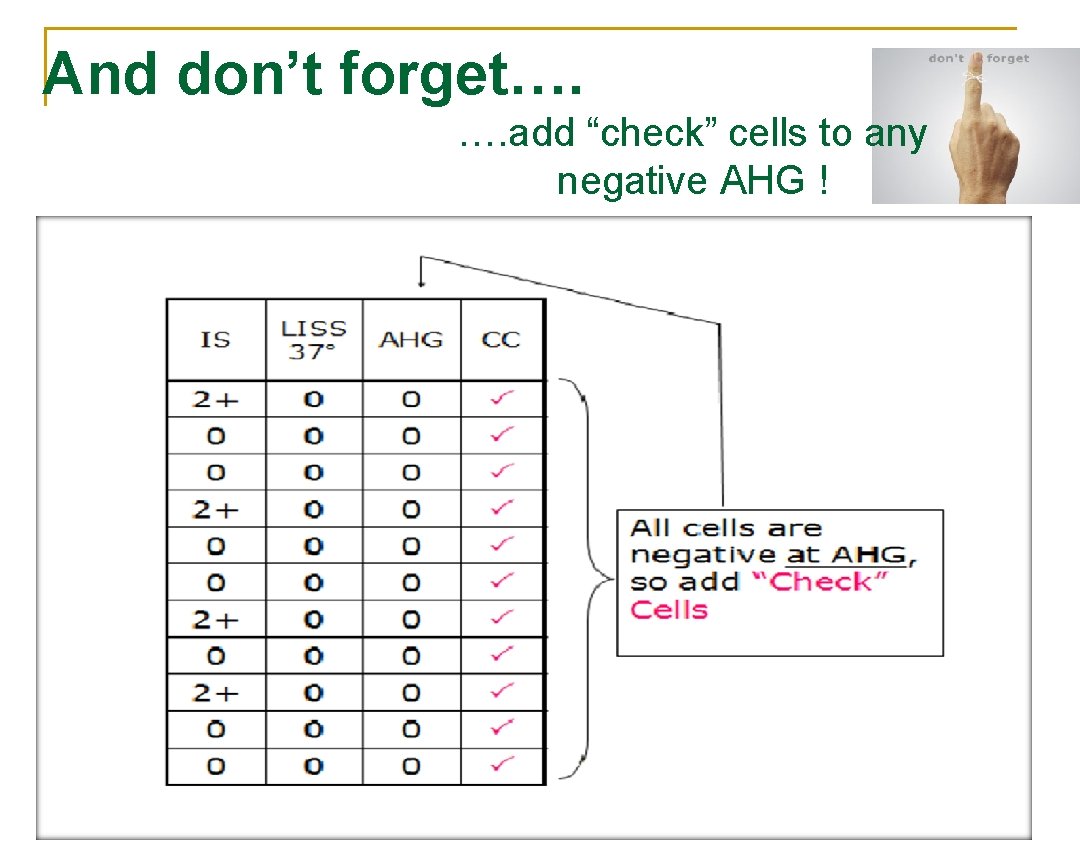 Practical Blood Bank Lab 7 Antibody Identification Antibody