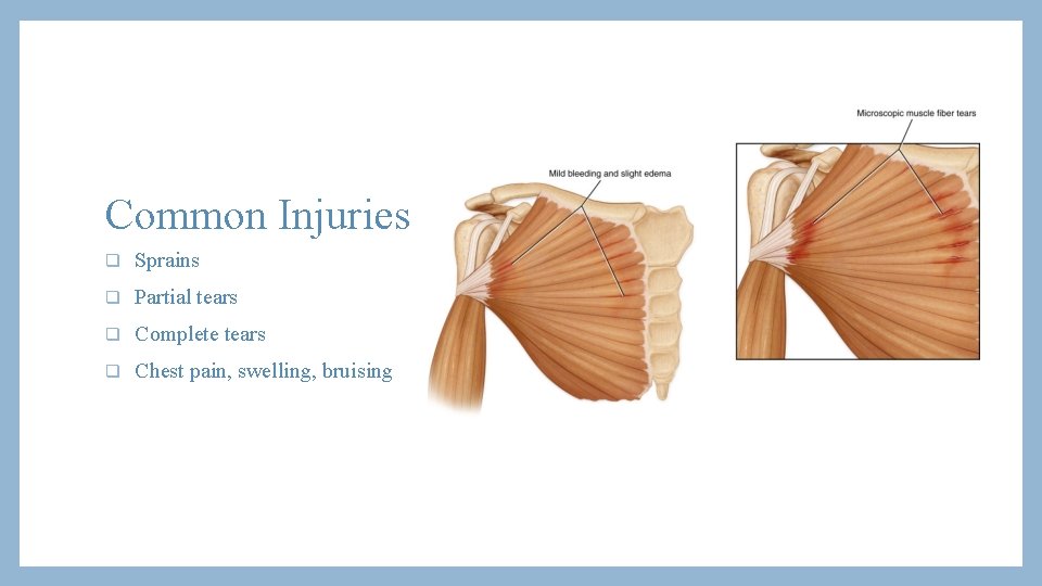 PECTORALIS MAJOR Miranda Shelley Science Investigations Type of