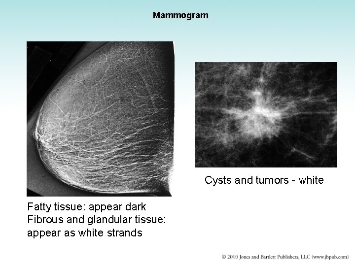 Chapter 16 The Breast Learning Objectives Describe normal