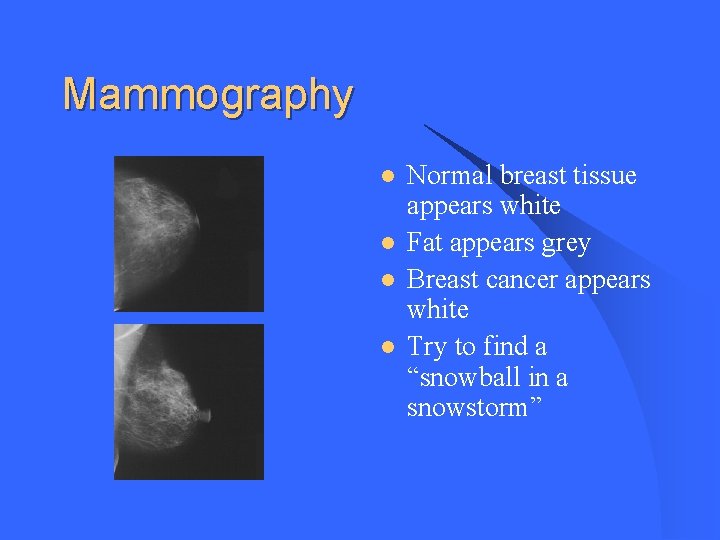 Emerging Technologies in Breast Cancer Imaging Roger M