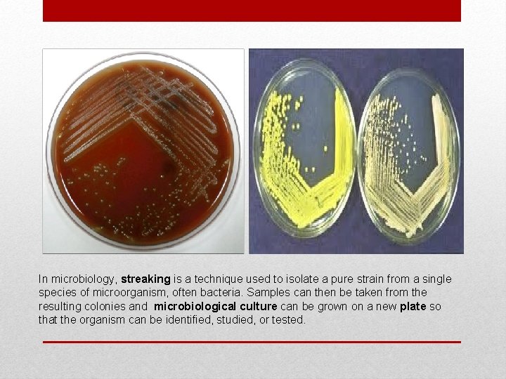 Culture Media BY Prof Dr Ghada Fahmy Helaly