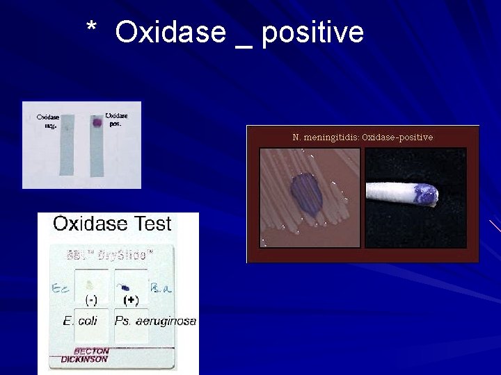 Pseudomonas Identification Done By Omniya Tayem Dr Adbelraouf