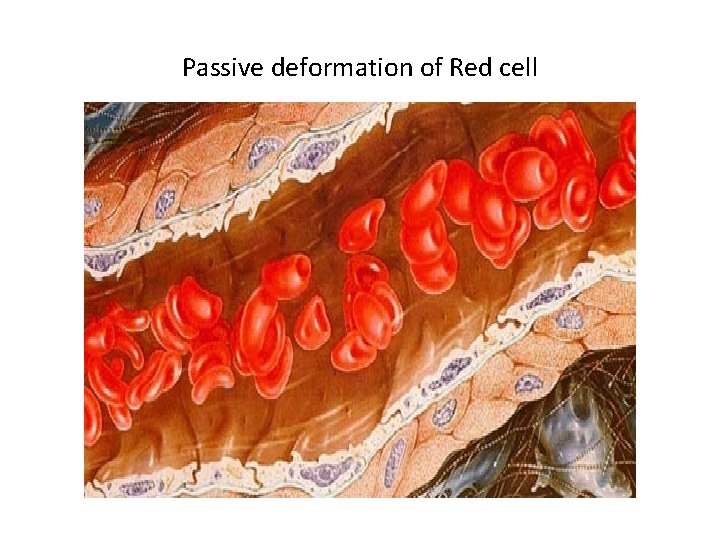Abnormalities of Red Cell membrane Lecture NO 1