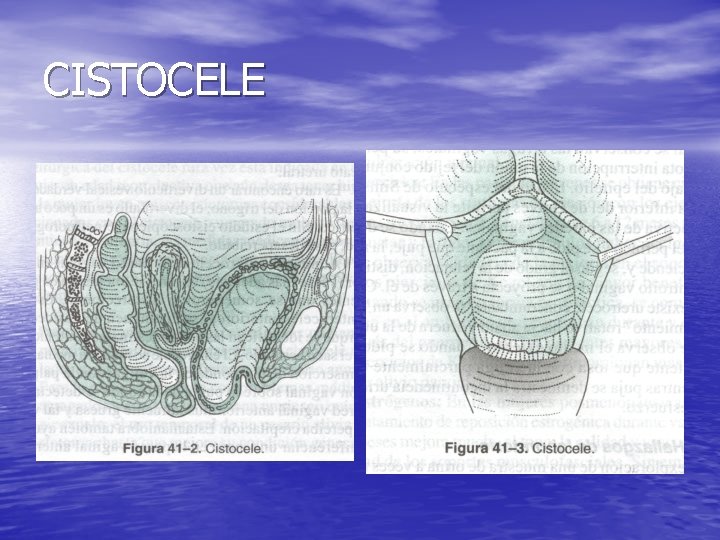 RELAJACION DEL PISO PELVICO Dr Johnny Olmedo Soriano