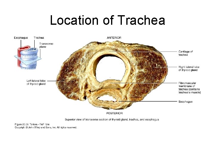 Trachea Extends from larynx to superior border of