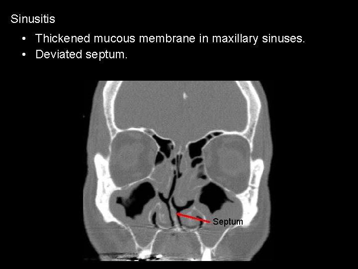 Respiratory Module Anatomy by Radiology Welcome to this